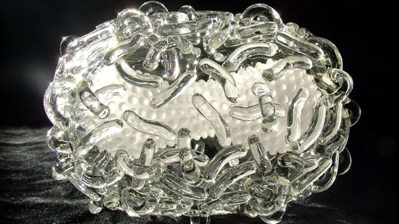 Ciencia y Más: Aparecen nuevas muestras de viruela en EE.UU | Onda Cero ...