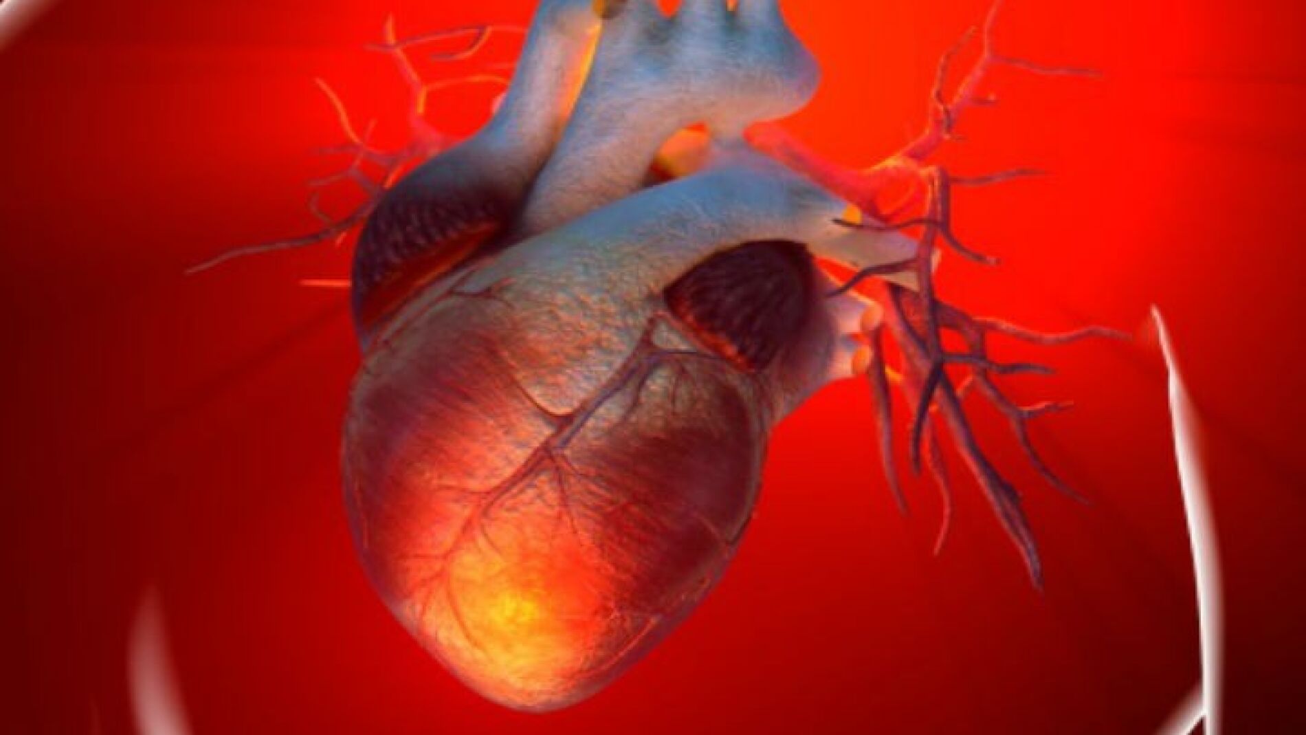 Elche: las patologías del corazón son causa directa en el Hospital ...