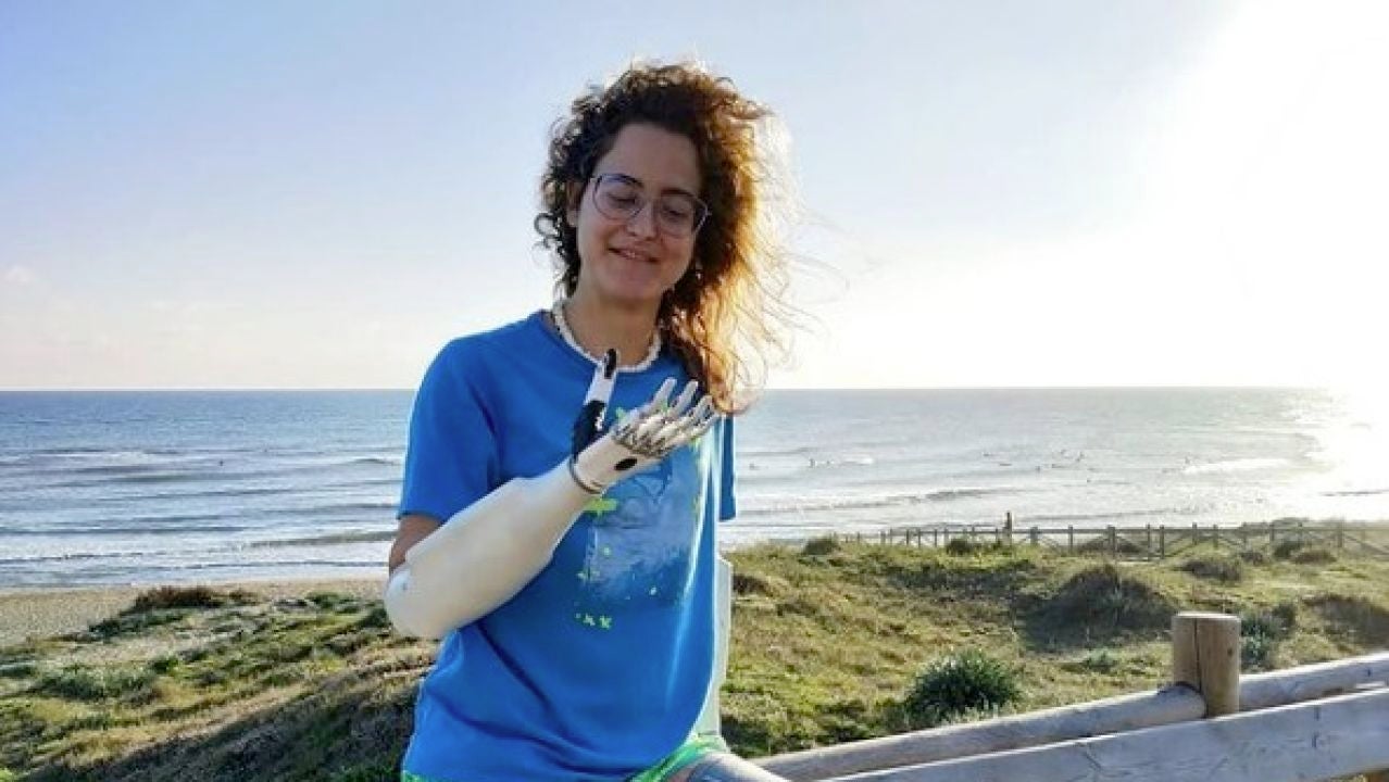 Sarah Almagro, de sufrir amputaciones en todas las extremidades a ser ...