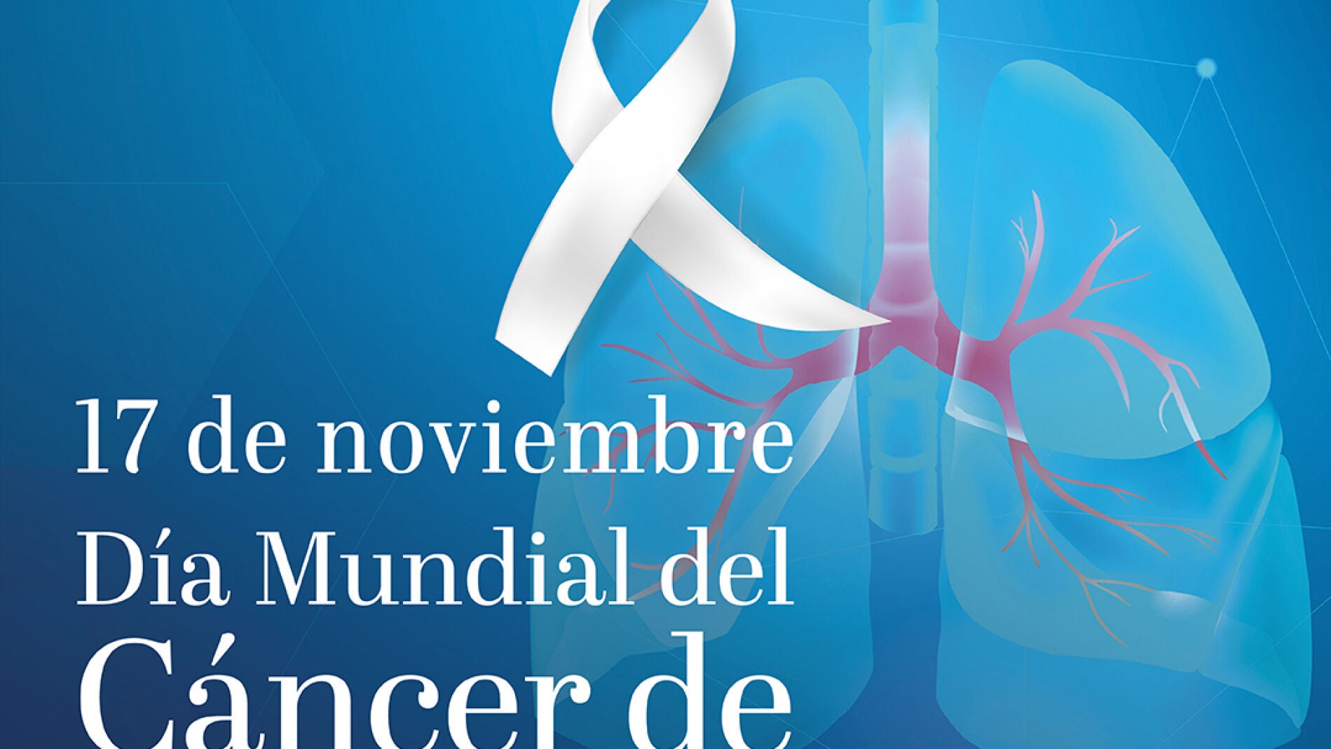Día Mundial del Cáncer de Pulmón: los neumólogos anuncian el comienzo ...